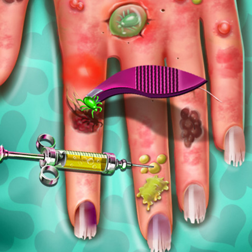 Play Hand Skin Doctor - Play on ABCya Games
